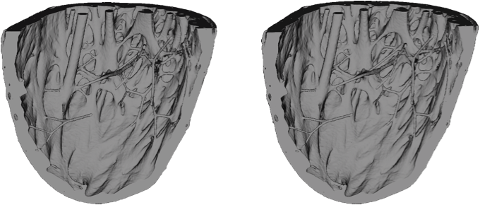 Rabbit Right-Ventricular Free Wall Cross-Eye Stereogram | Brock's Blog
